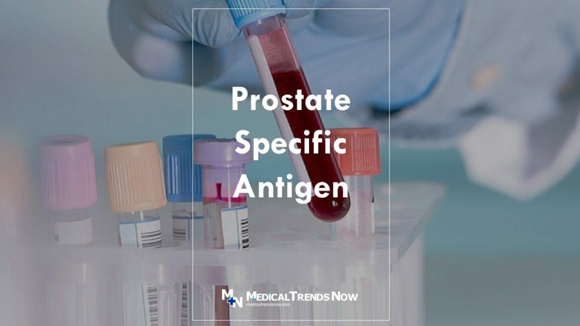 Prostate Specific Antigen Testing Is Important For Filipino Men